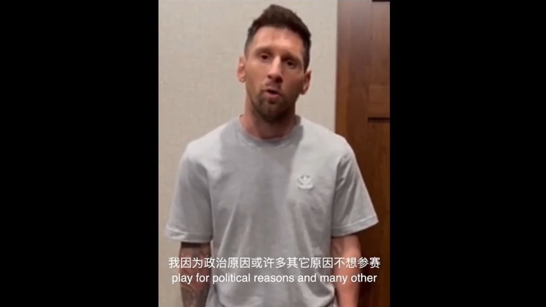 美斯否認因政治原因不想在香港上陣 重申因傷｜本地｜商業電台 881903