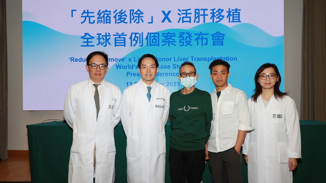 港大團隊研發治療肝癌新方案 切除晚期和年長病人腫瘤｜本地｜商業電台 881903